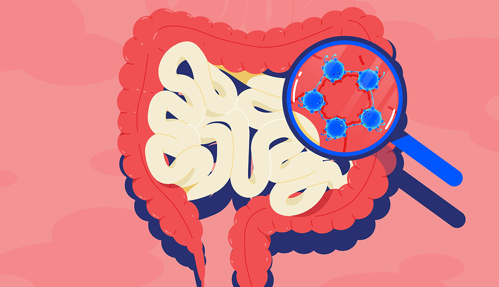 Gut Testing Explained