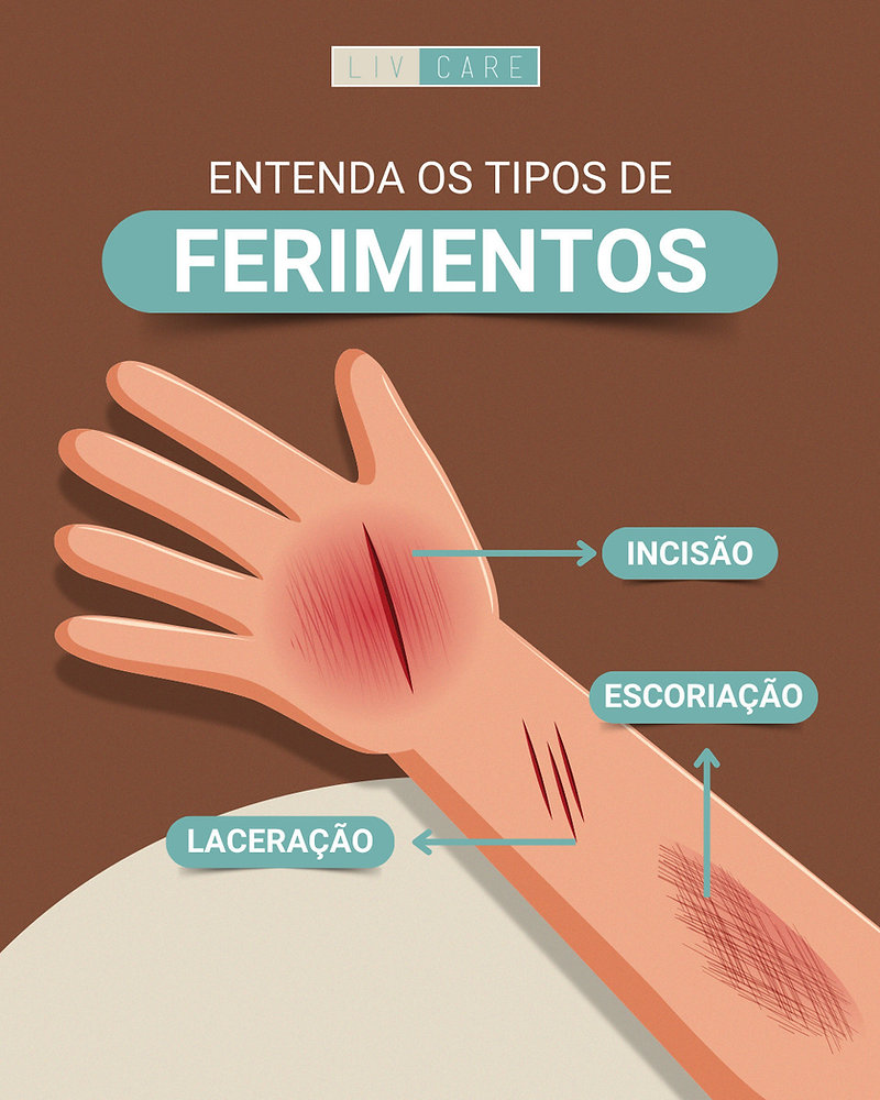 Entenda os tipos de ferimentos