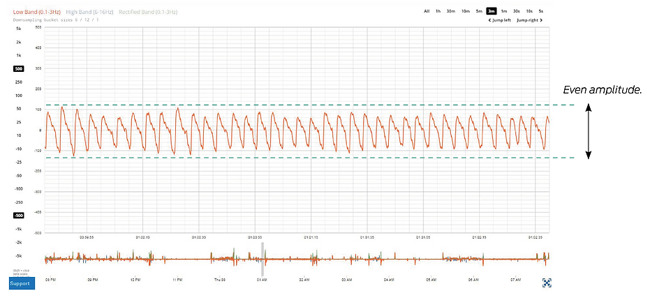 SLEEP APNEA SCORING | EMFIT SENSORS