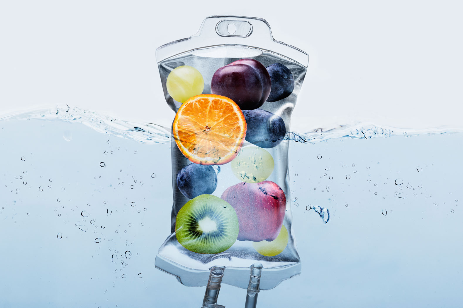 Normal Saline vs Balanced Fluids — What Does Recent Literature Say ...