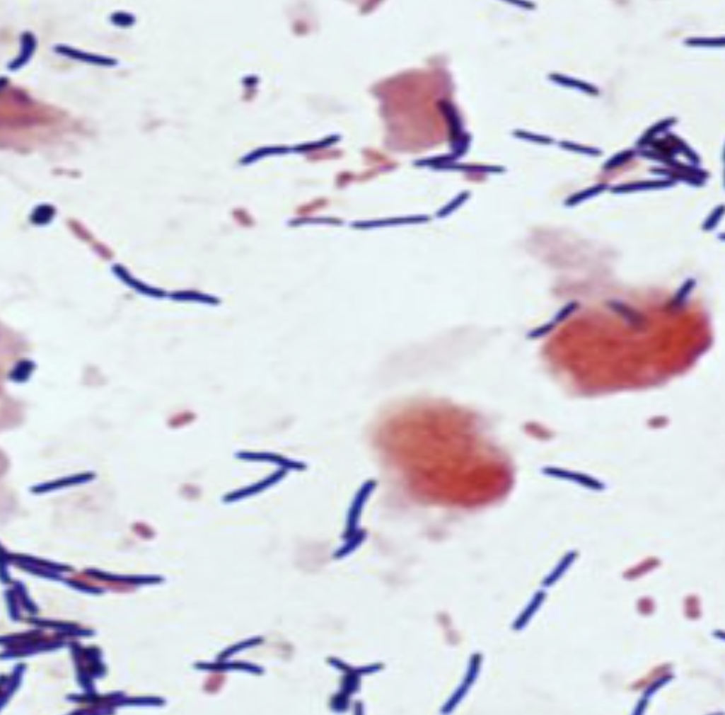 Gram-positive bacilli of clostridium difficile on culture. | Internal ...