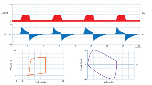 Ventilator Graphics: Loops and Scalars | ICU REACH