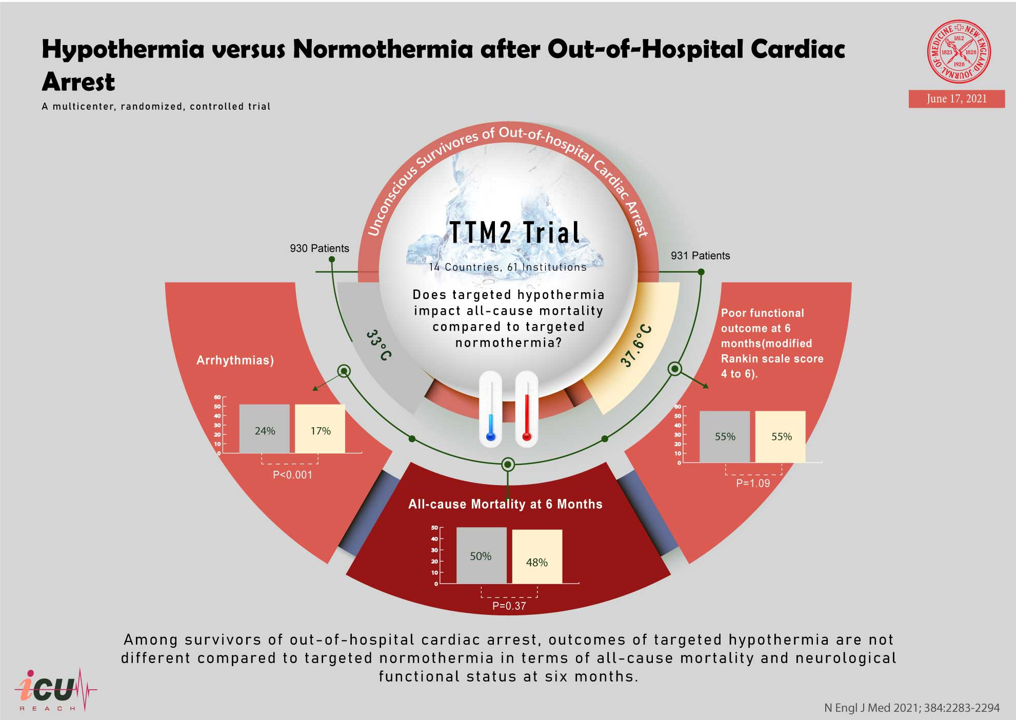 TTM2 Trial | ICU REACH