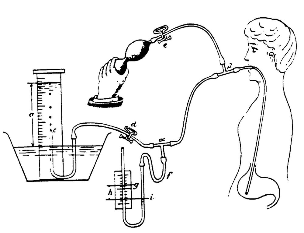 The Invention of the Laparoscopy (1901)