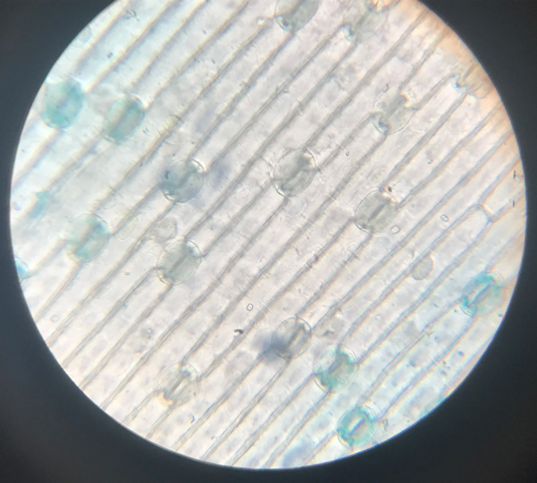 #HoyEnPrácticas: Observación de la epidermis vegetal