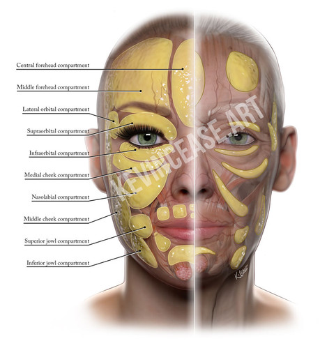 Aging Fat Pads Labelled LICENCED DOWNLOAD | KevinCeaseArt