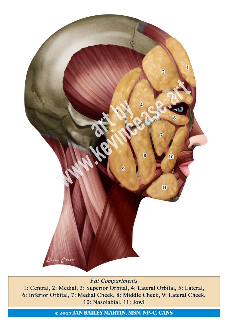 Side view fat pads of the face