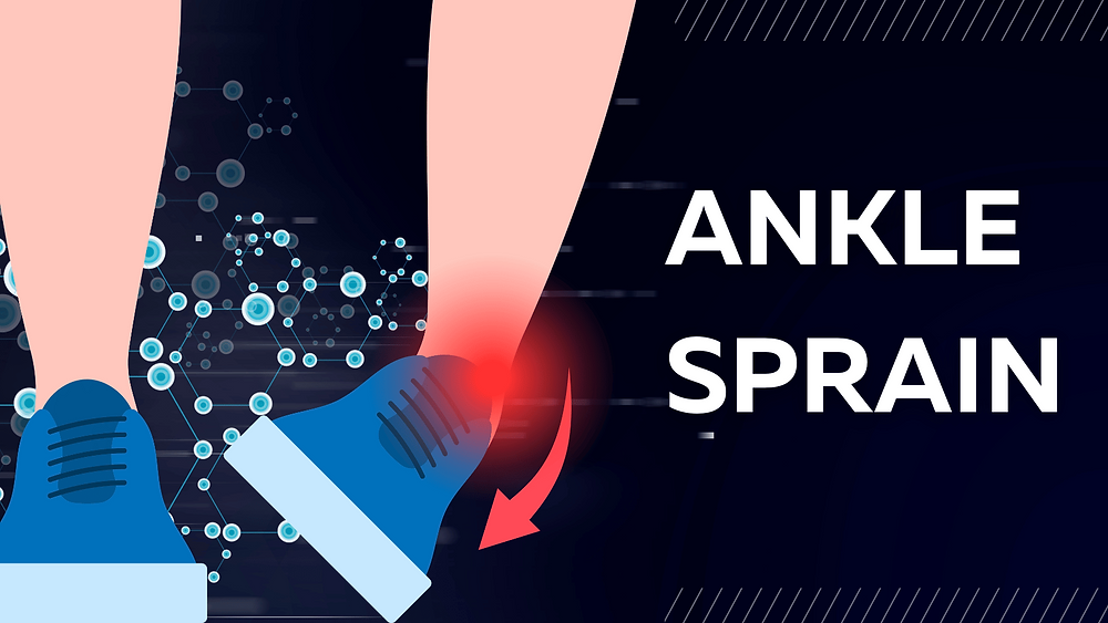 Ankle Sprain 101: What You Need to Know About This Common Injury