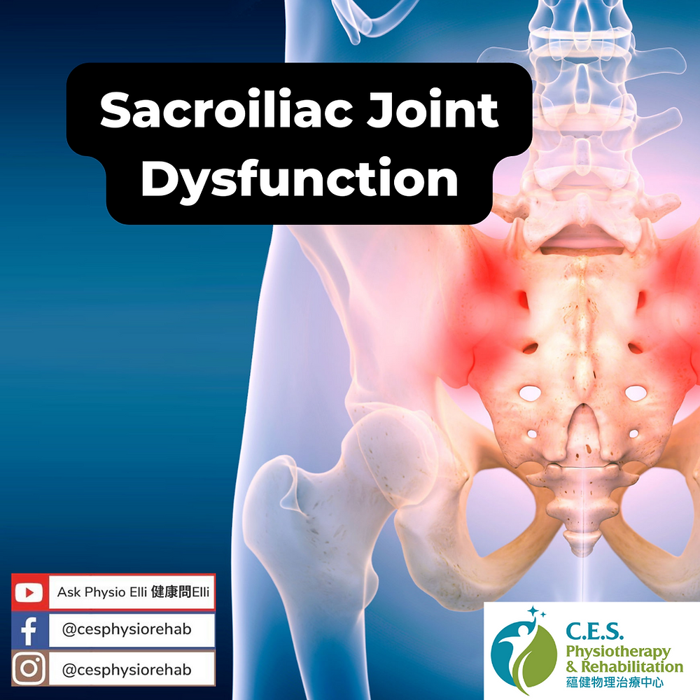 Sacroiliac Joint Dysfunction