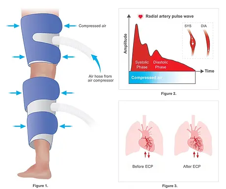 Home | Ecp Therapy Solution