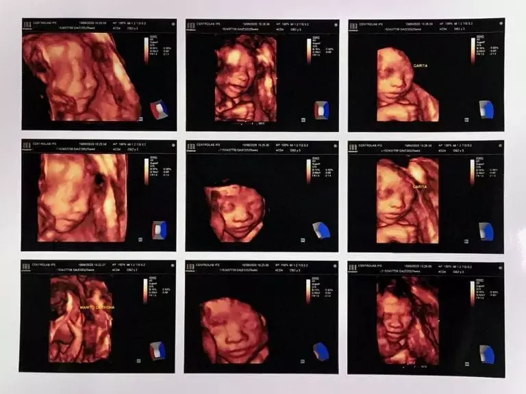 Ecografía 3D y 4D de Alta Definición | Centrolab | Medellín