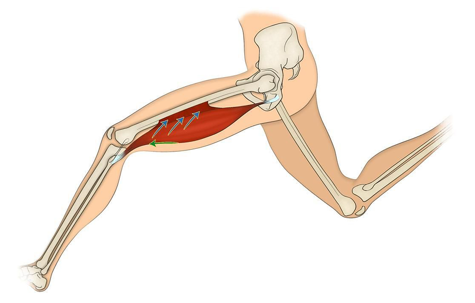 LE CLAQUAGE DES ISCHIOJAMBIERS