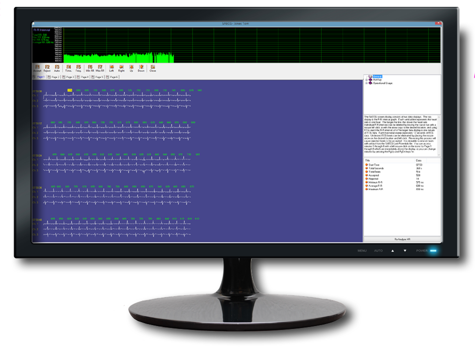 CardioScan Holter Analysis Software-Cardiac Event Software
