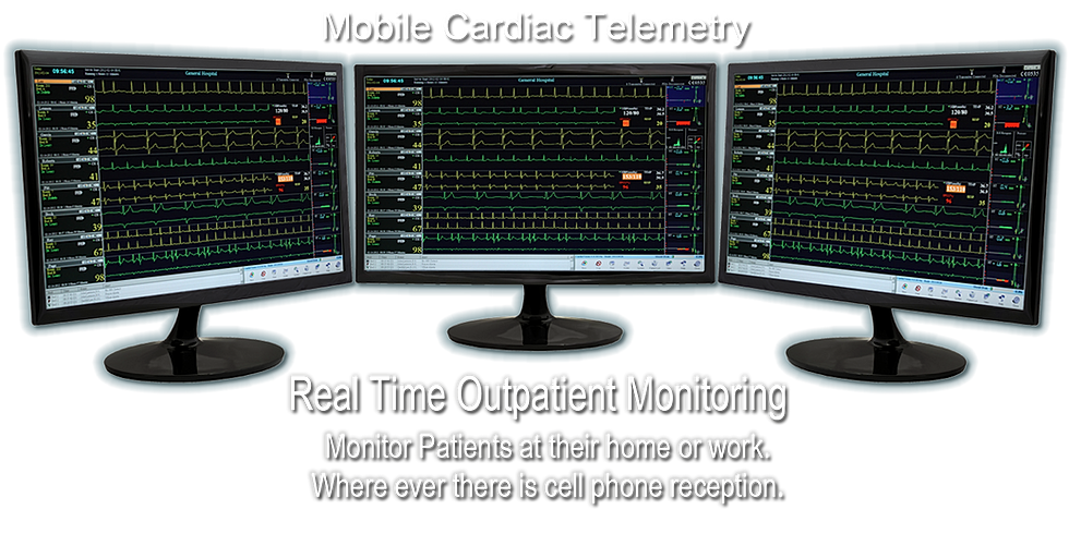 Real Time Mobile Cardiac Telemetry, MCT, MCOT, ROCT, Cellular.