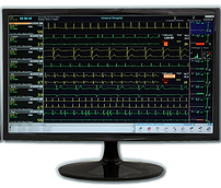 Cardiac Rehab - Cardiac Rehabilitation Central Stations