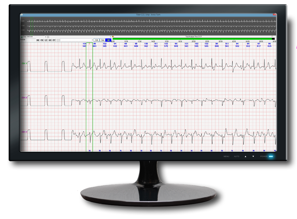 CardioScan Holter Analysis Software-Cardiac Event Software