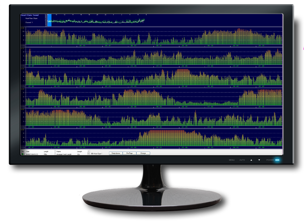 CardioScan Holter Analysis Software-Cardiac Event Software