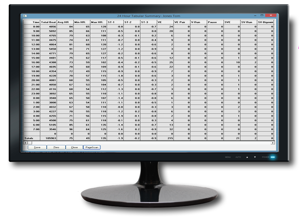 CardioScan Holter Analysis Software-Cardiac Event Software