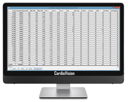 CardioVision Wi-Fi "All In One" Telemetry Central Station