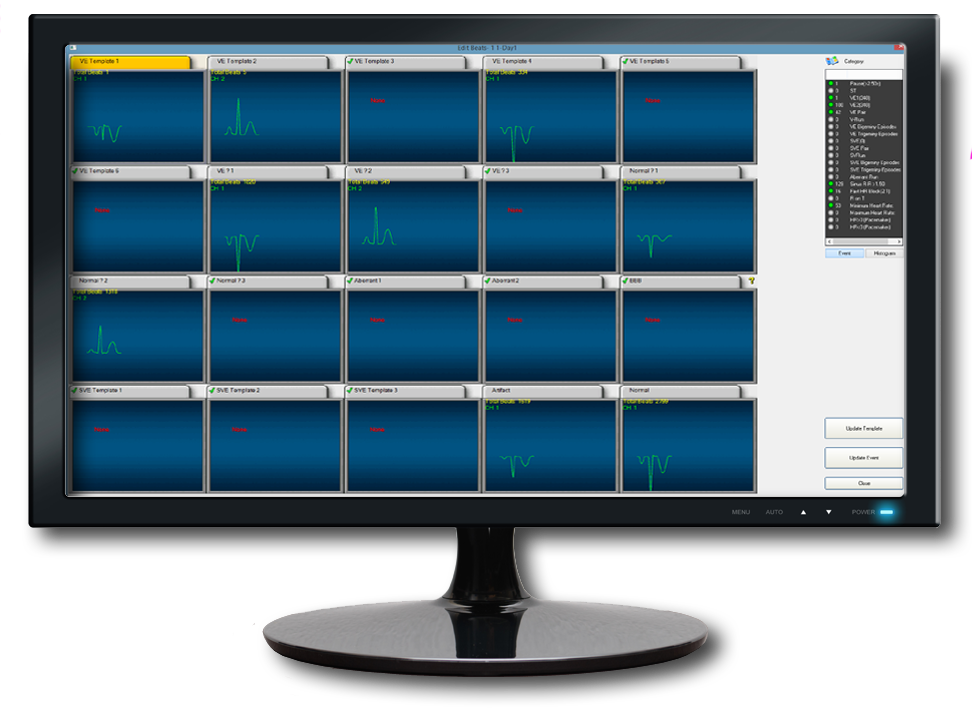 CardioScan Holter Analysis Software-Cardiac Event Software