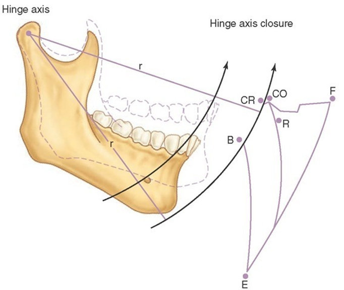 What is "CENTRIC RELATION"