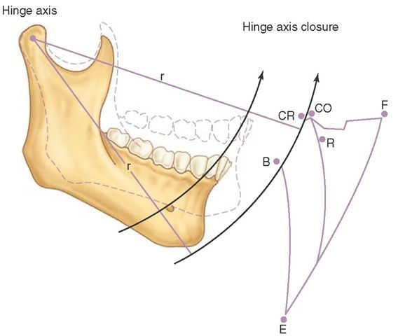 What is "CENTRIC RELATION"