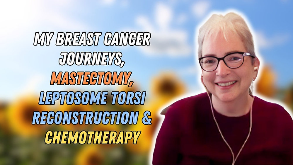 Liza Fues is a two-time breast cancer survivor, opting for mastectomy ...