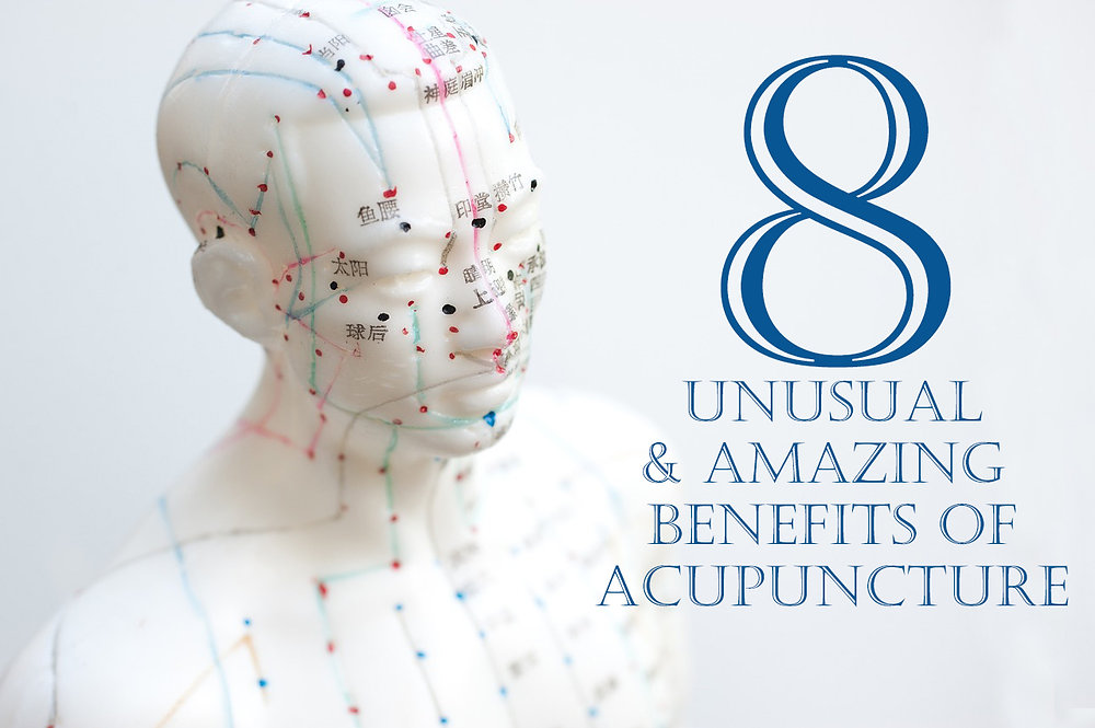 8 Unusual and Amazing Benefits of Acupuncture