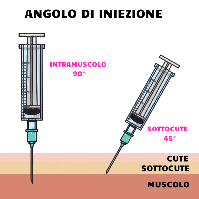 Iniezione sottocutanea : come fare una puntura
