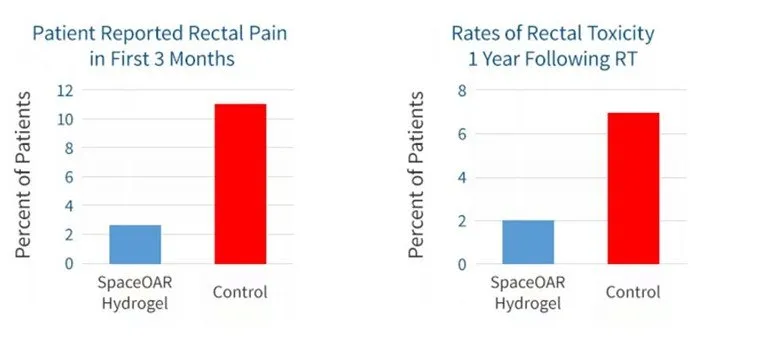Advanced Radiation Therapies | Rio Bravo Cancer Cen