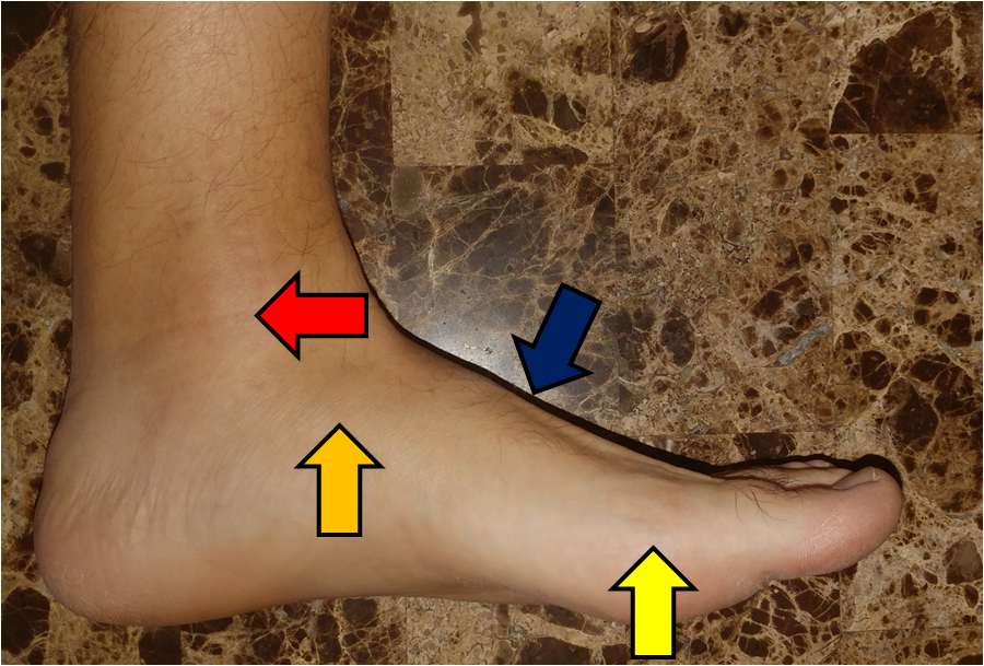 Surface Anatomy of the Foot