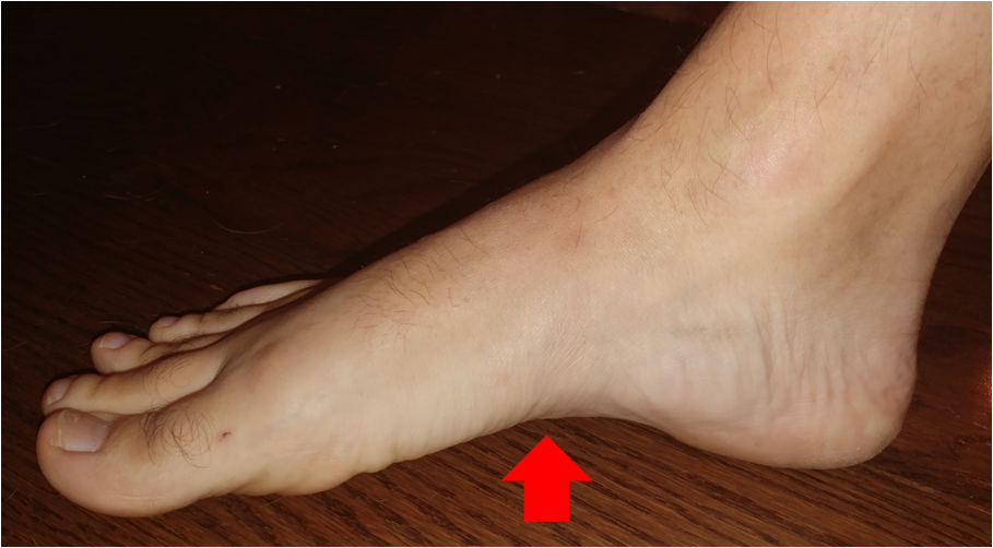 What is Pronation and Supination?