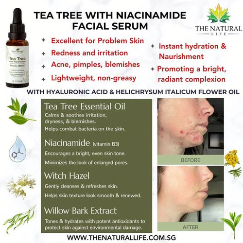 Plant Therapy Tea Tree with Niacinamide Facial Serum | The Natural Life ...