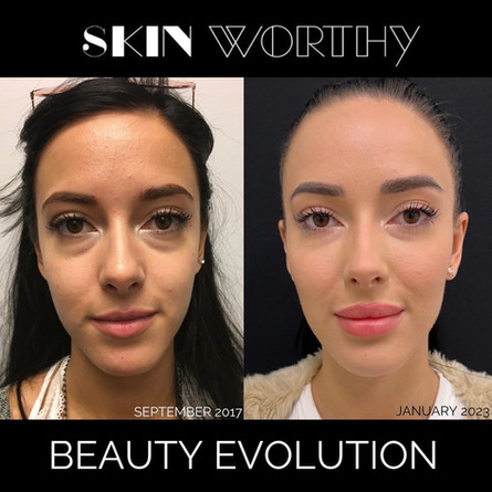 Beauty Evolutions | Skin Worthy | Medical Aesthetic Clinic in Toronto