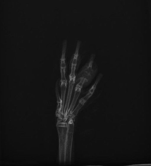 Rabbit Osteomyelitis and Thymoma Management for Queen's Patient at Long ...