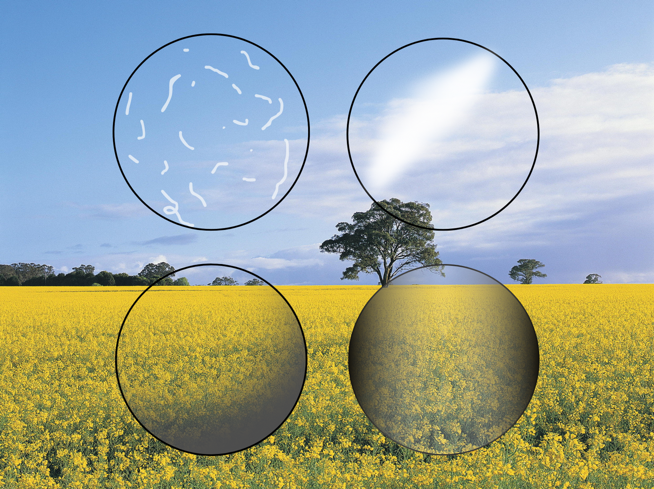 retinal tear vision changes