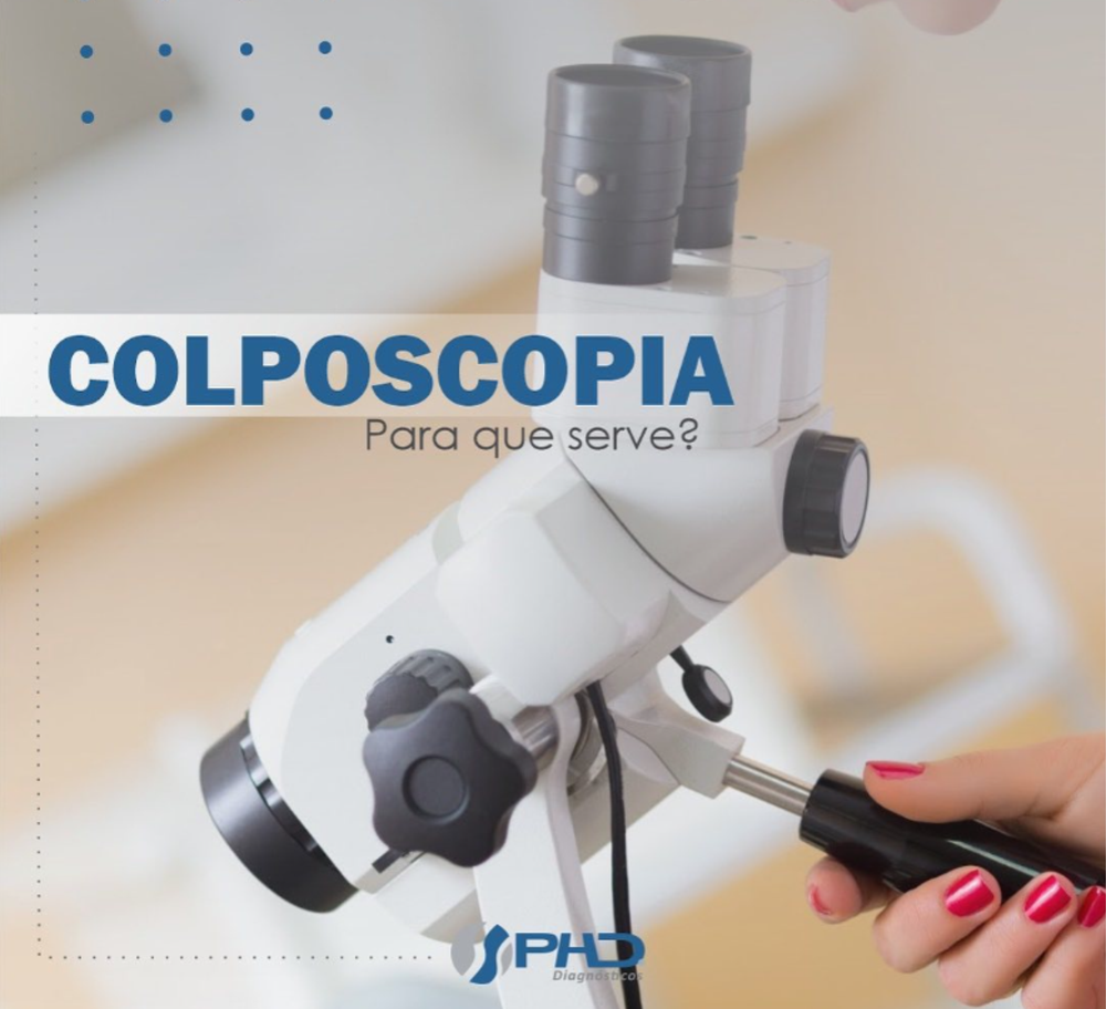 COLPOSCOPIA - Saiba tudo sobre este exame!