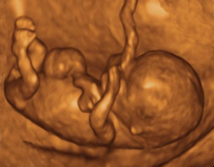 The unborn is a human being: What science tells us about unborn childr