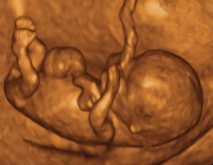 The unborn is a human being: What science tells us about unborn childr