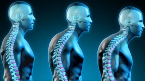 How to Analyze and Improve Posture Deviations March 28th, 2026 | omaha ...
