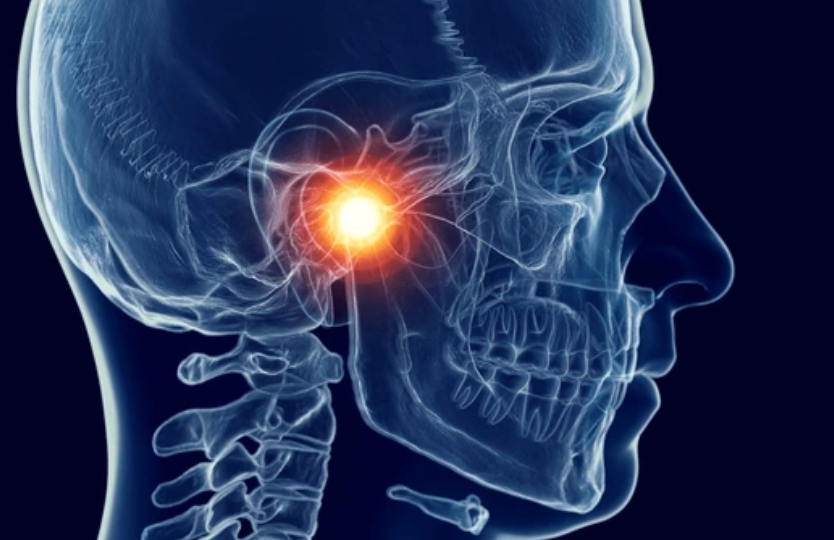 Can an Ear Infection Cause Jaw Pain? The Link Between Ear and Jaw ...