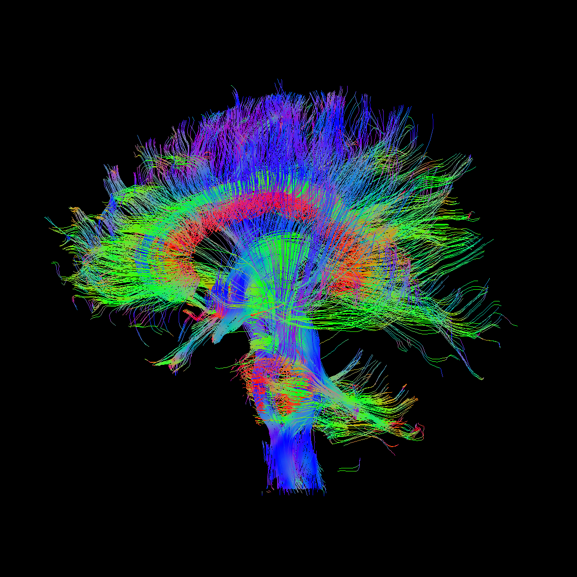 Traumatic Brain Injury | Shin-Imaging