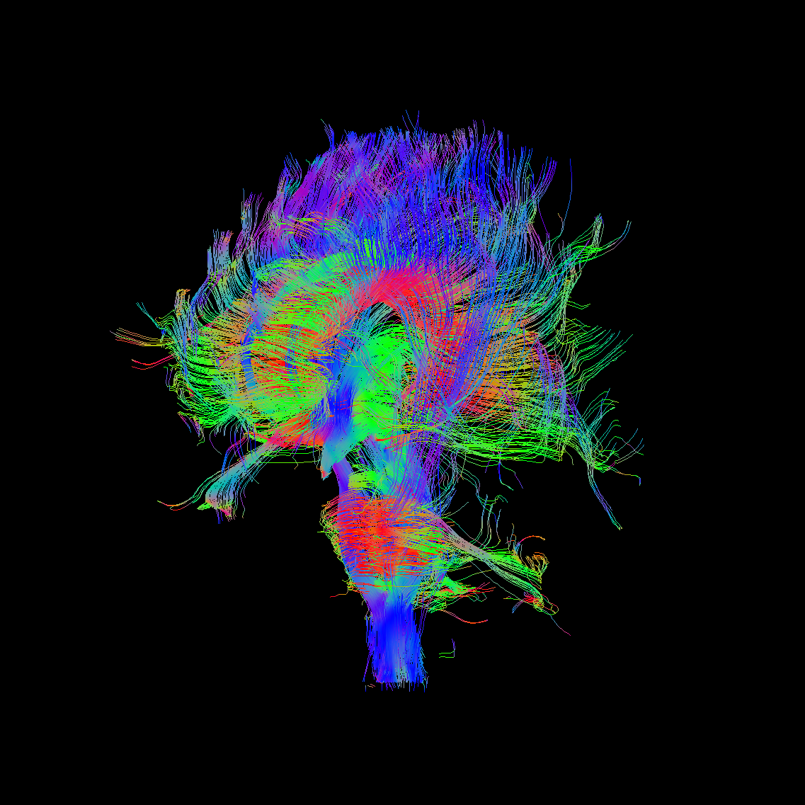 Traumatic Brain Injury | Shin-Imaging