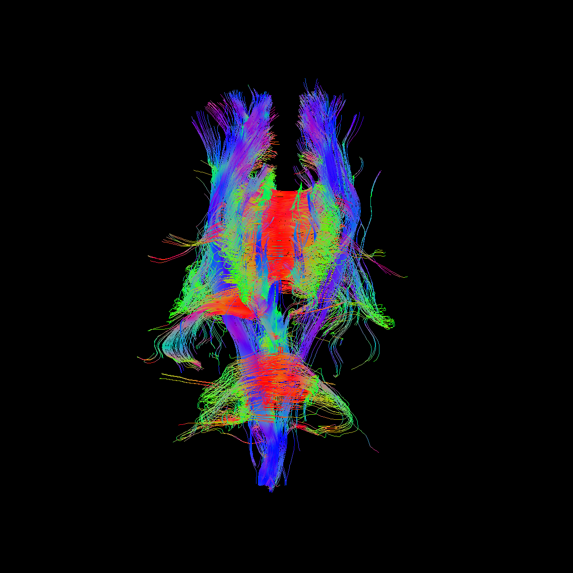 Traumatic Brain Injury | Shin-Imaging