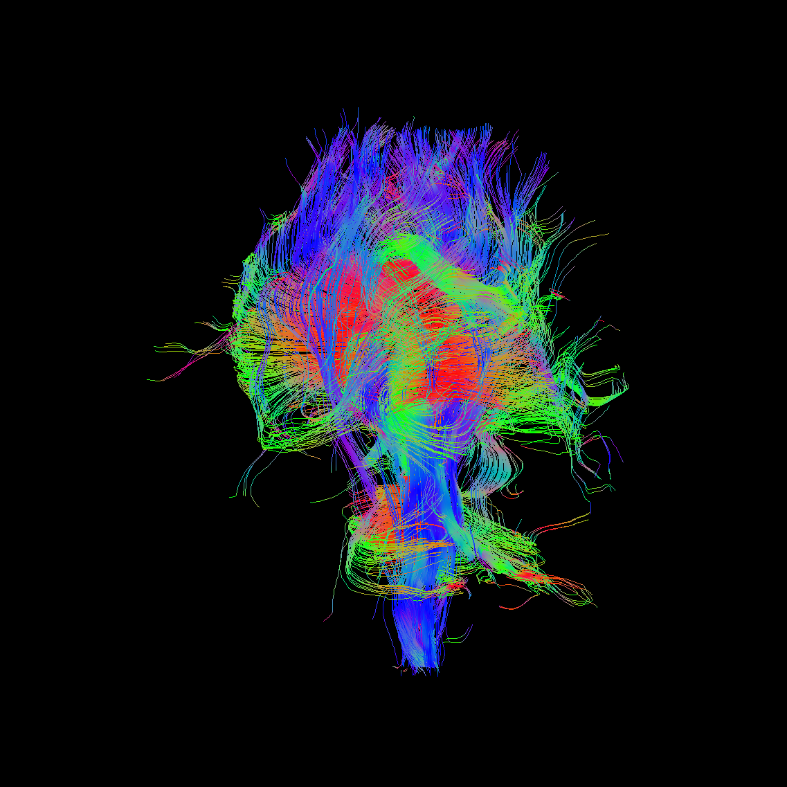 Traumatic Brain Injury | Shin-Imaging