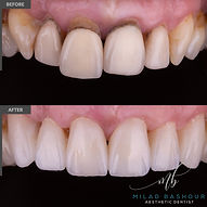 COSMODENT | Dr. Milad Bashour | Aesthetic Dentist