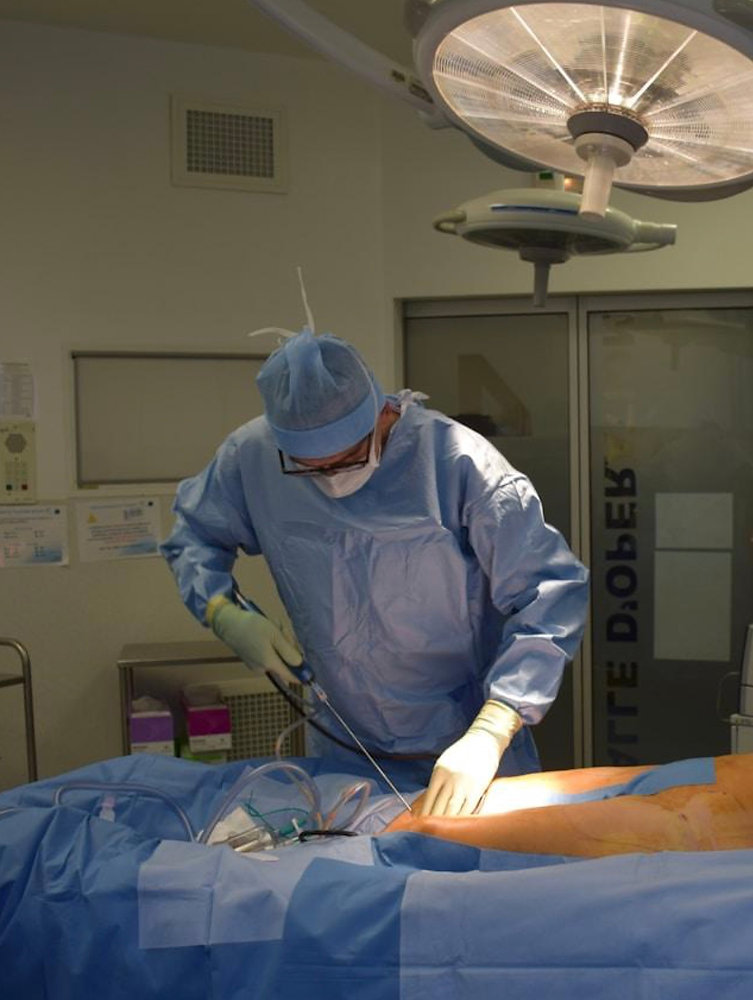 Improving Post Surgery Results with Levant Liposuction Guidance