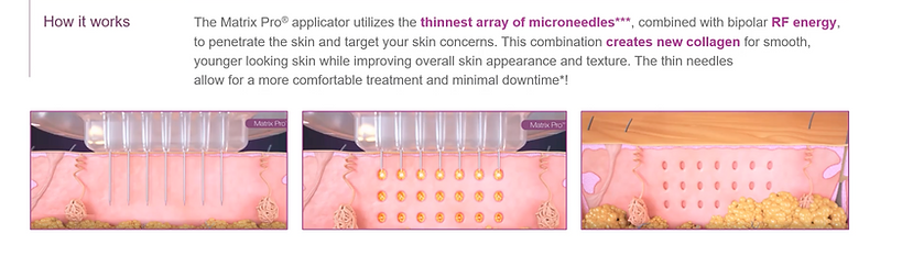 RF Microneedling | FSIM-KOP