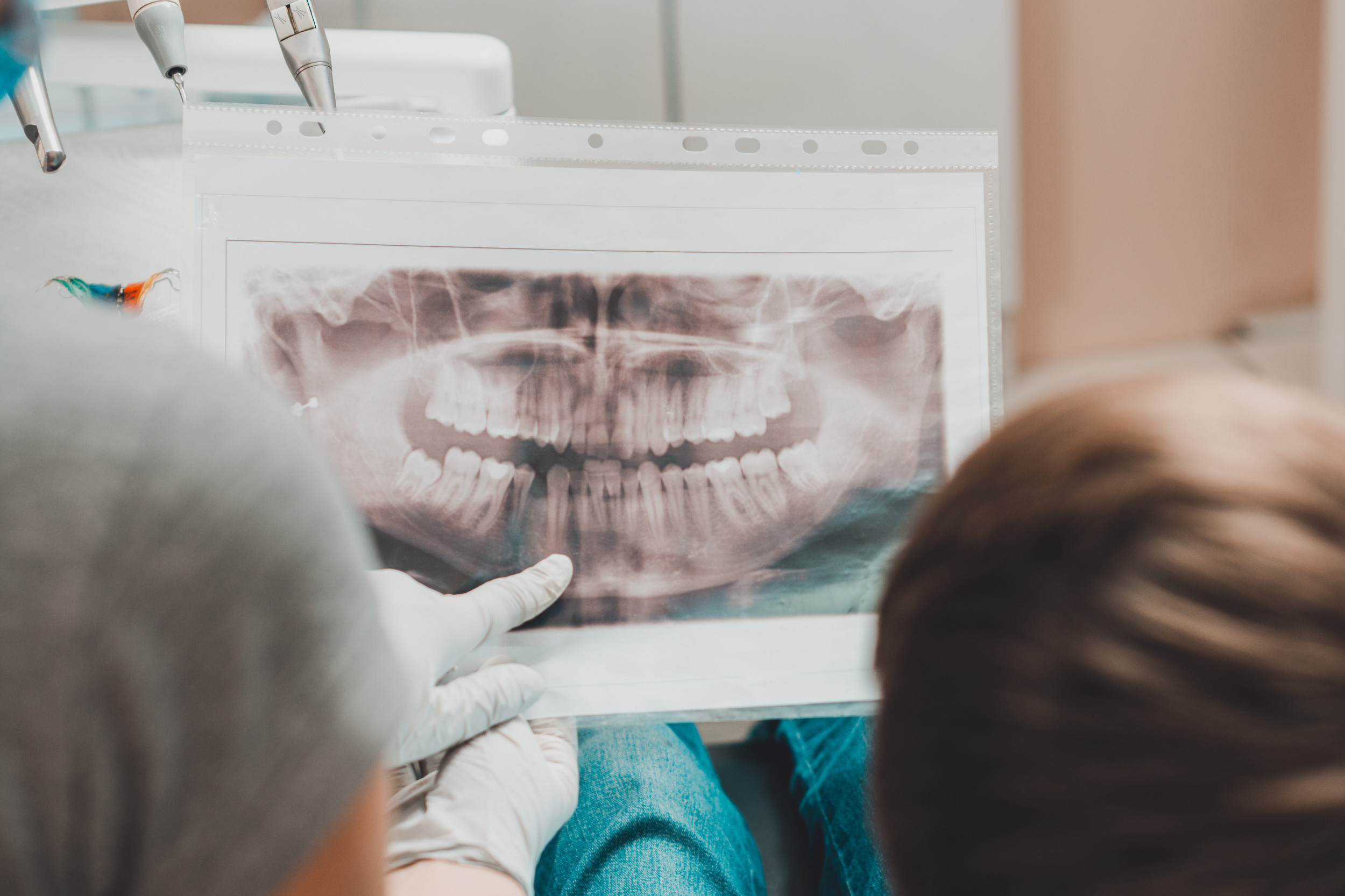 Tooth Extraction Guide | Blackall Terrace Dental Tooth Extraction Guide | Blackall Terrace Dental