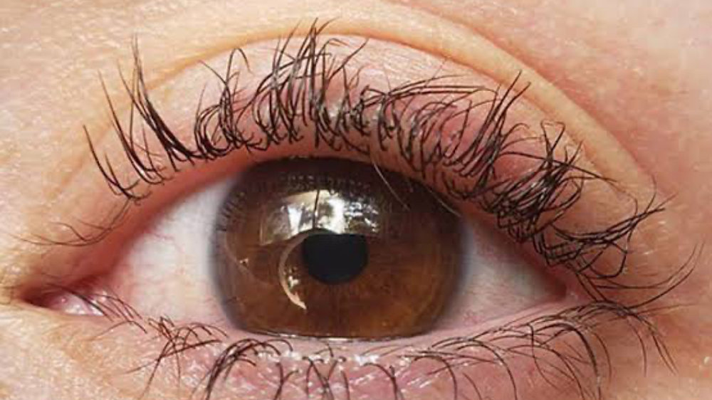 Lash Lift Gone Wrong Mai Lashes Brisbane Woolloongabba Toowong Cbd